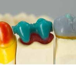 GEO PONTICS WAX PONTICS, RENFERT Others Selangor, Malaysia, Kuala ...
